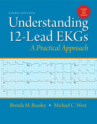 Understanding 12-Lead EKGs 3rd edition | 9780132921060, 9780133463804 ...