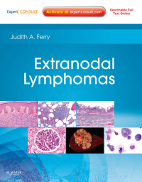 Extranodal Lymphomas | 9781416045793, 9780323246293 | VitalSource