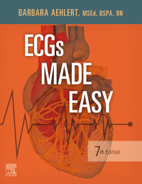 ECGs Made Easy - E-Book 7th edition | 9780323794251, 9780323832939 ...